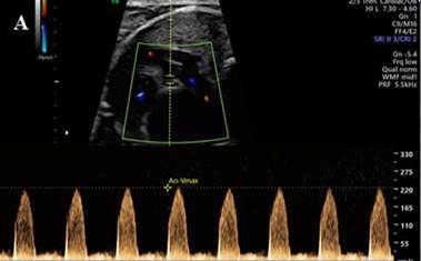 Descripción: img354