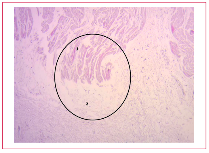 El fulcro cardíaco y su relación con el nódulo auriculoventricular