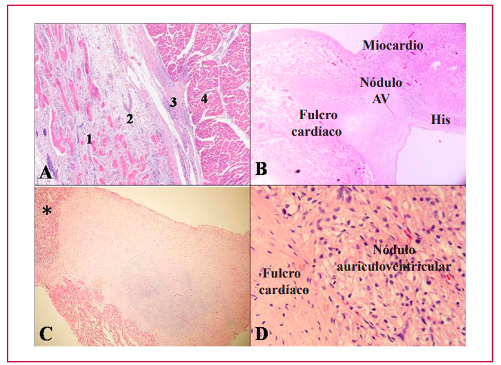 El fulcro cardíaco y su relación con el nódulo auriculoventricular